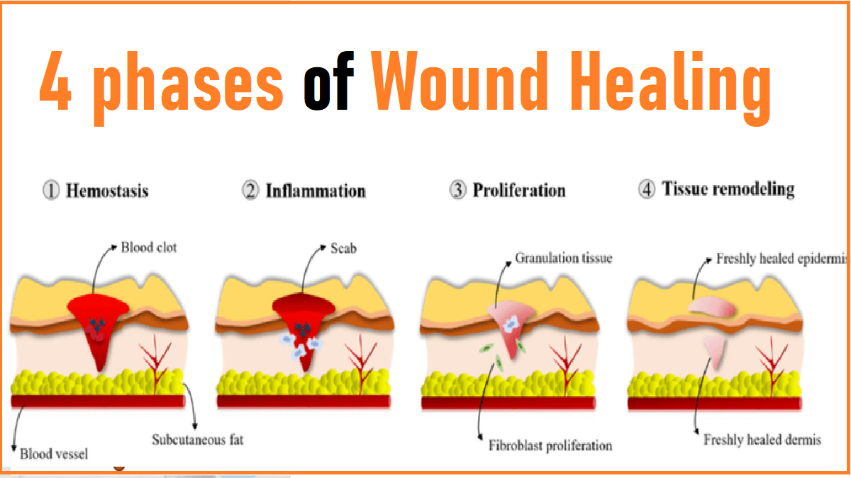 Advanced Woundcare Specialists